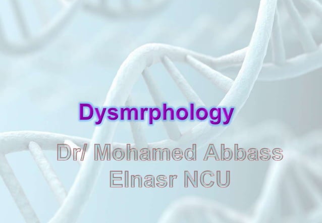 Dysmoorphology | PPT