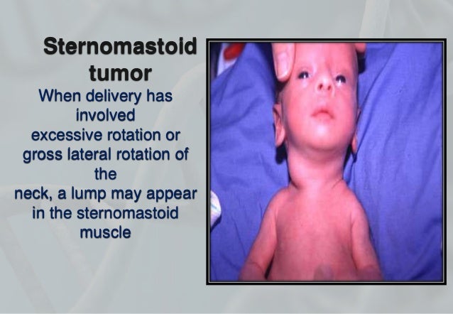 Dysmoorphology
