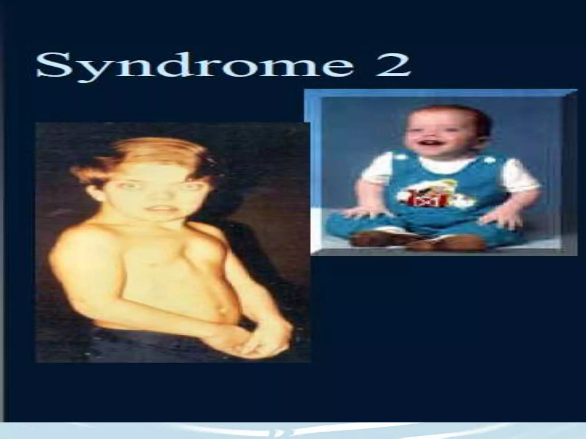 Approach to Dysmorphic Infant or Child | PPTX