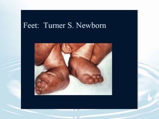 Approach to Dysmorphic Infant or Child | PPTX
