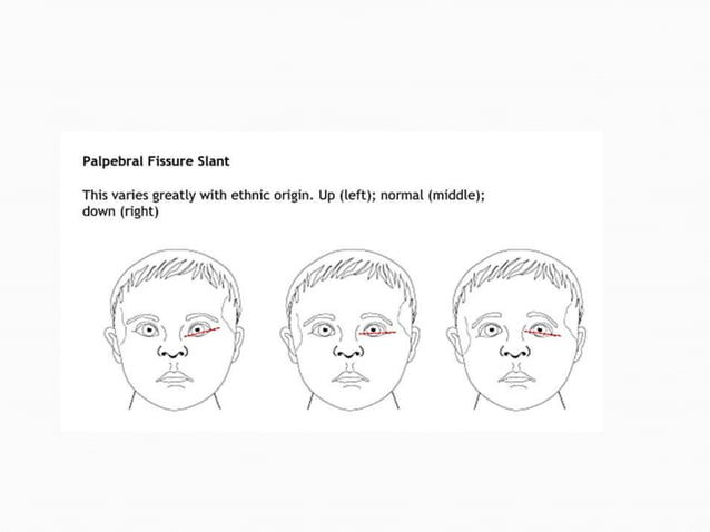 Dysmorphology Student upload Dr.Khaled.ppt