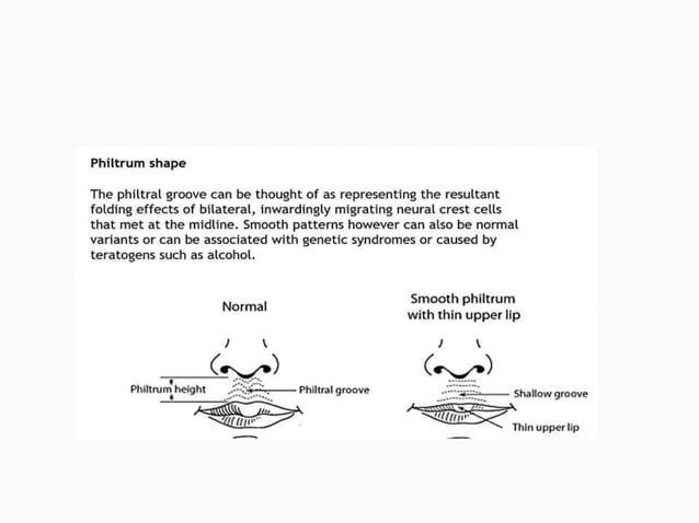 Dysmorphology Student upload Dr.Khaled.ppt