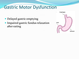 Dyspepsia | PPTX