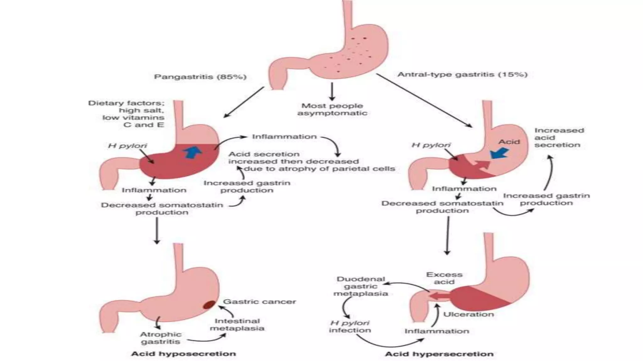Dyspepsia | PPTX | Digestive Disorders | Diseases and Conditions