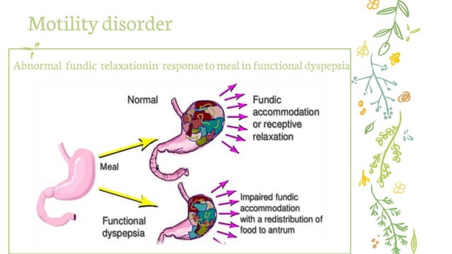 Dyspepsia | PPTX | Digestive Disorders | Diseases and Conditions