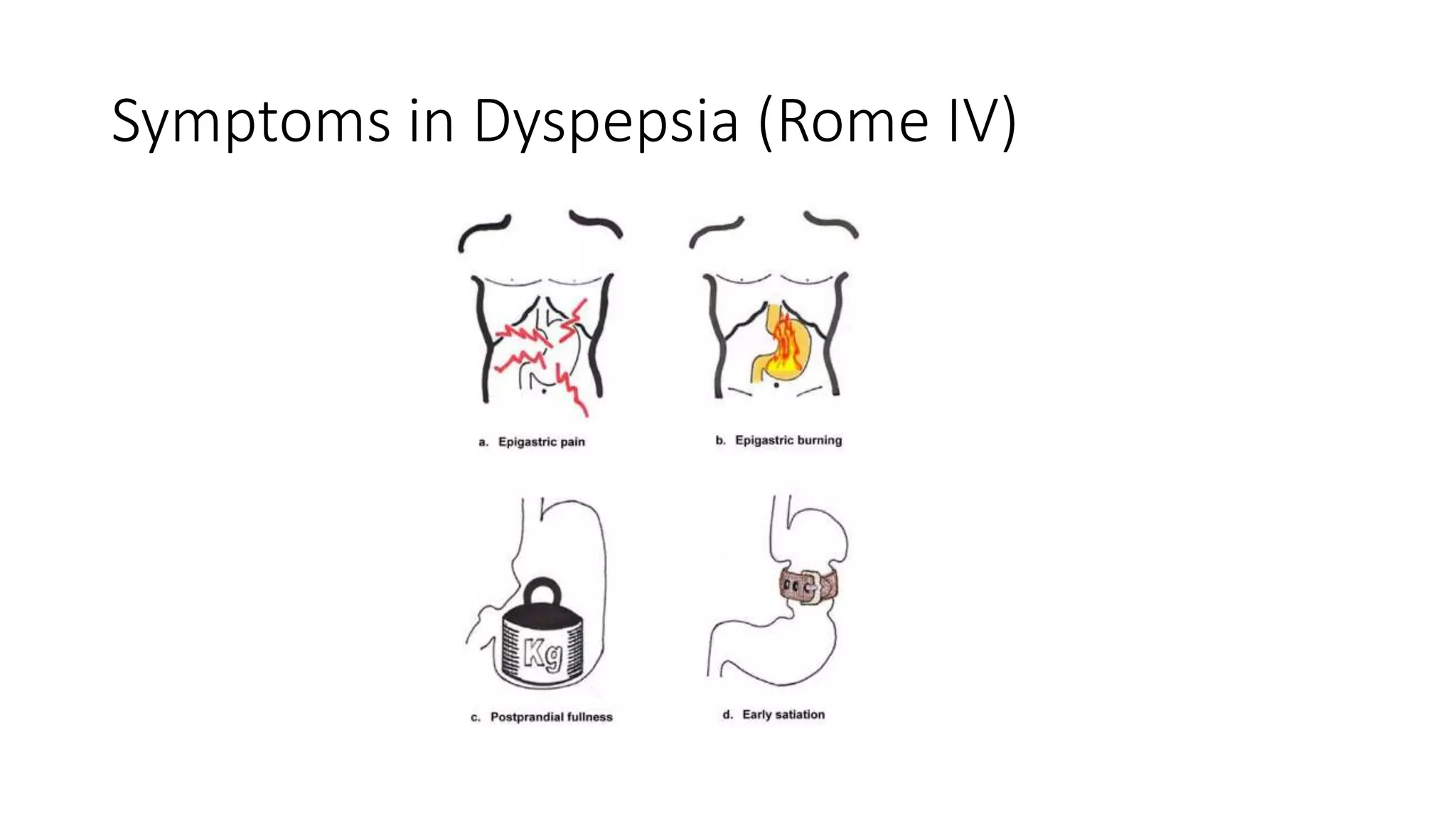 Dyspepsia.pptx