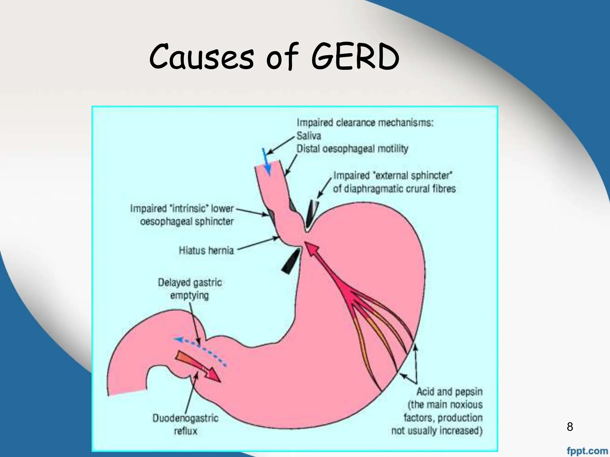 Functional DYSPEPSIA Gastroenterology MMA | PPTX