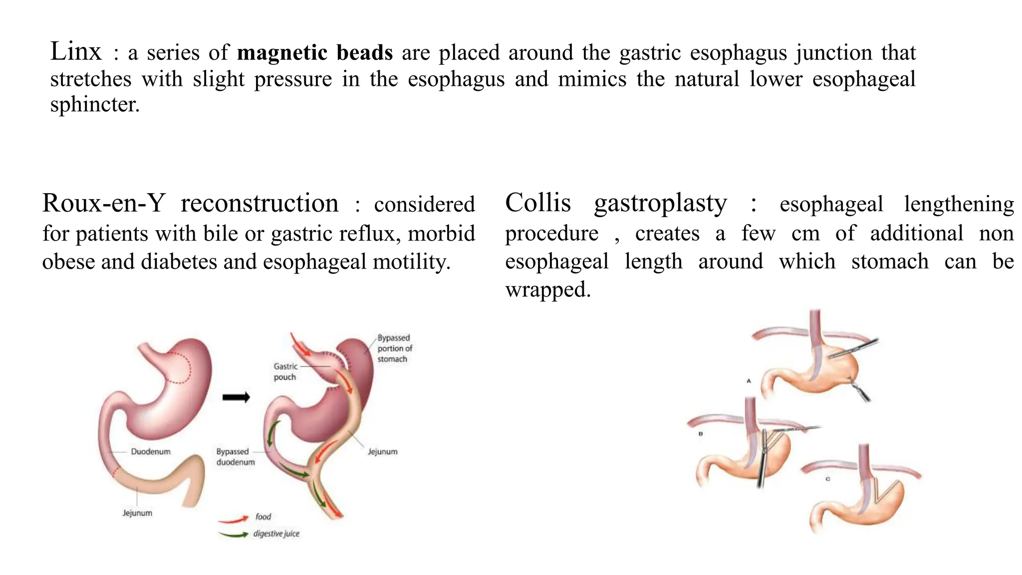 Evaluation and management of patients with Dyspepsia.pptx