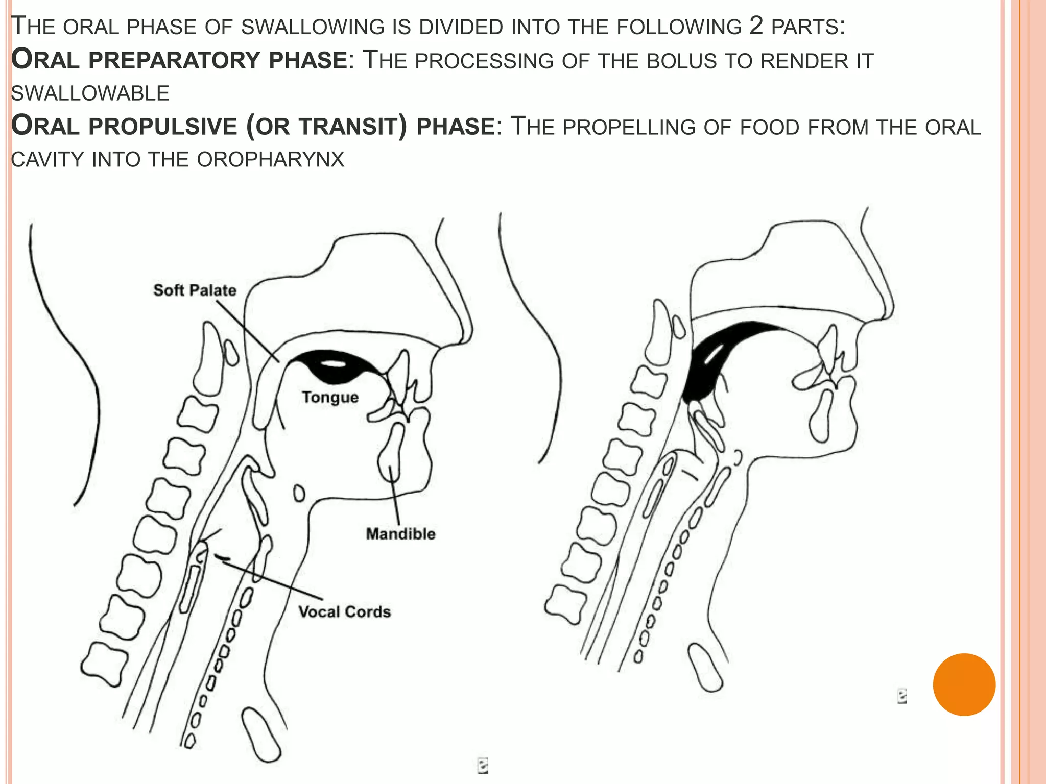 Dysphagia | PPTX
