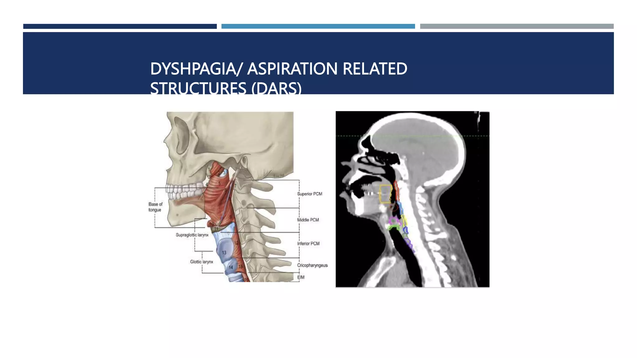 DYSPHAGIA.pptx