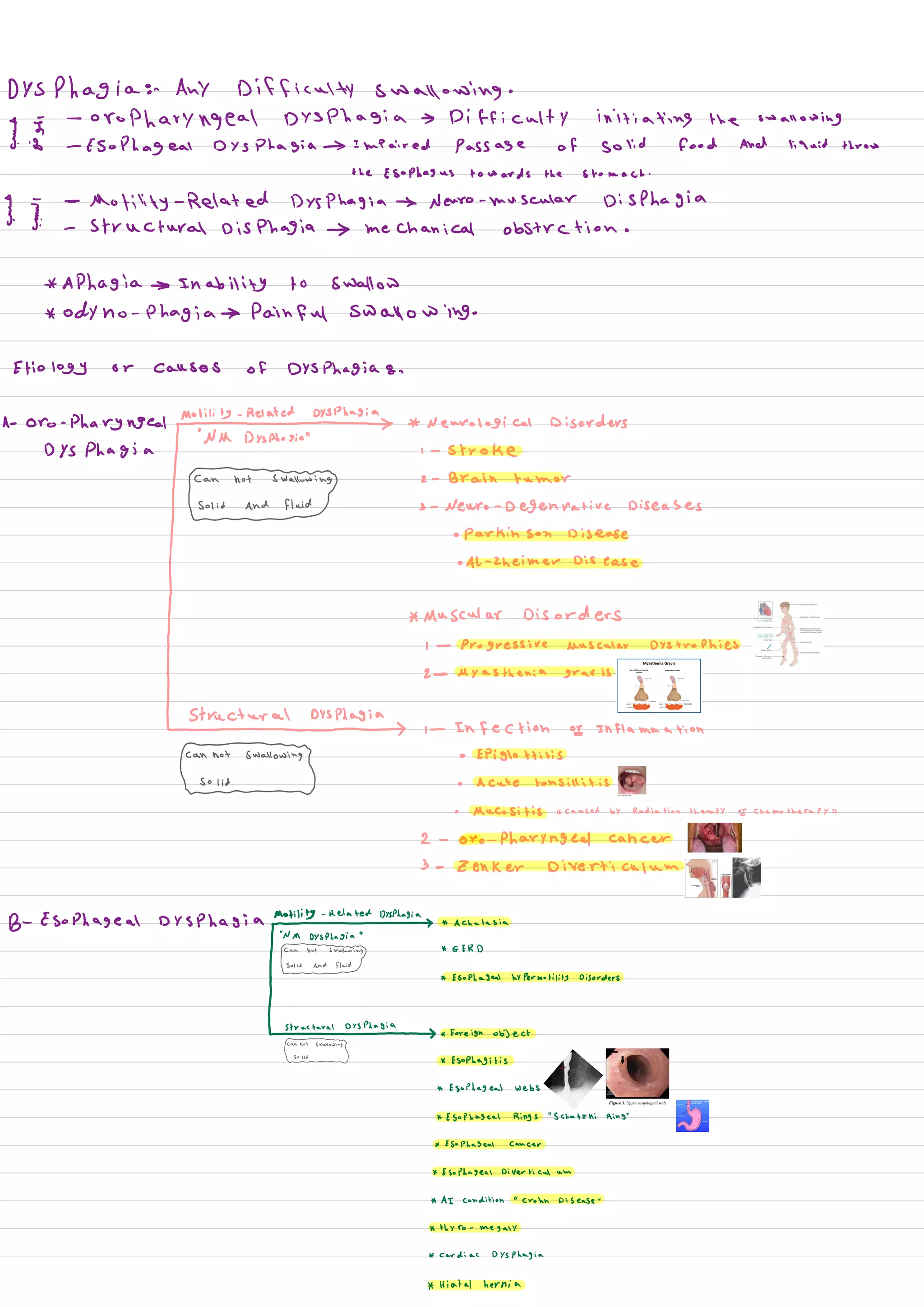 Dysphagia.pdf