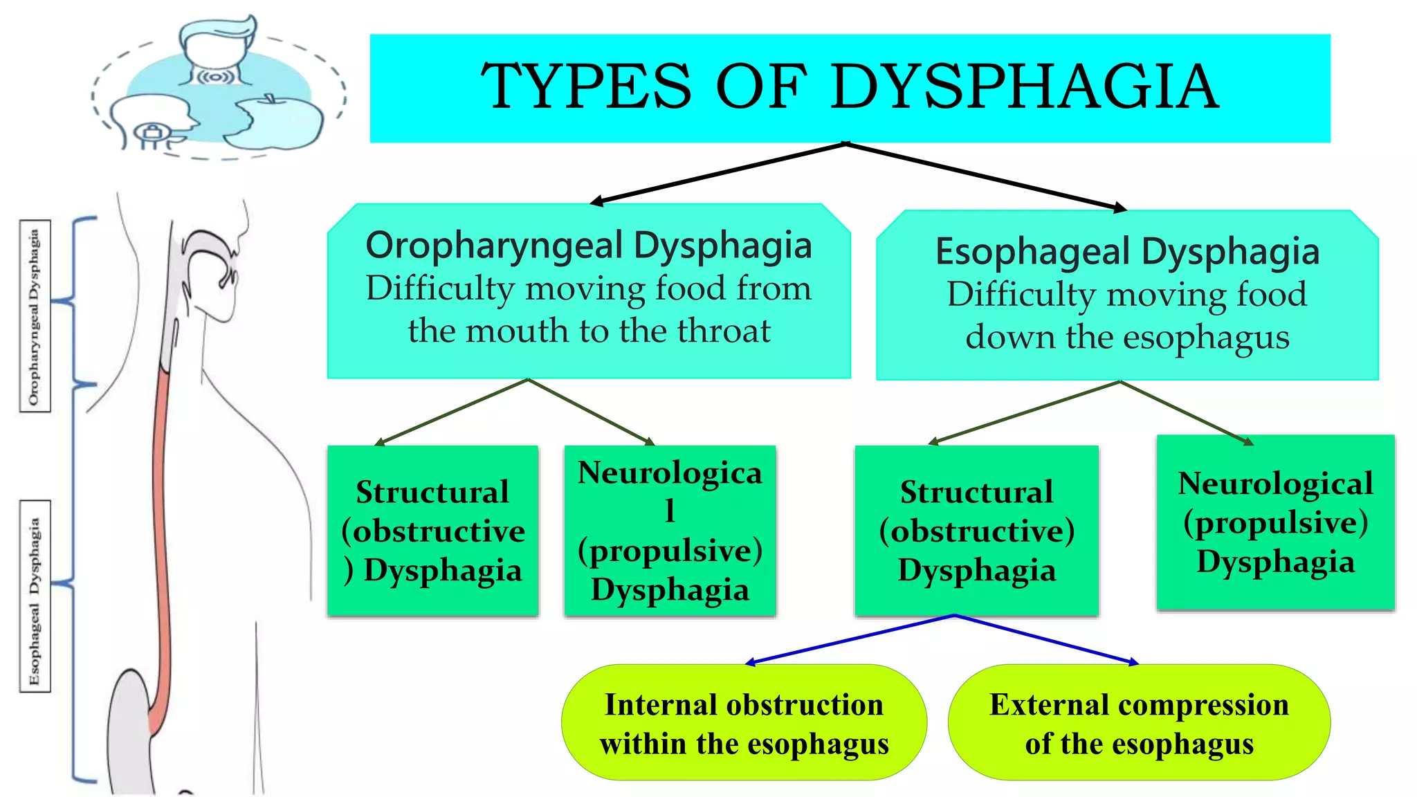 DYSPHAGIA.pptx