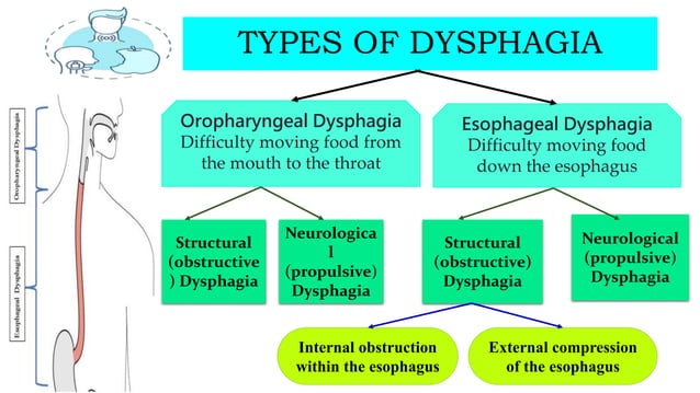DYSPHAGIA.pptx | Ear, Nose and Throat Conditions | Diseases and Conditions