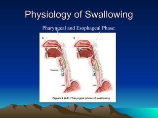 Dysphagia for Evaluation in Otorhinolaryngology.ppt