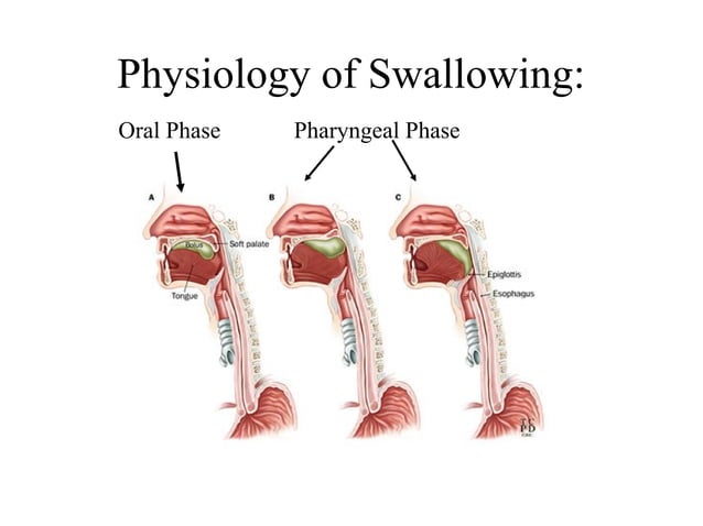 Differential diagnosis of Dysphagia.ppt