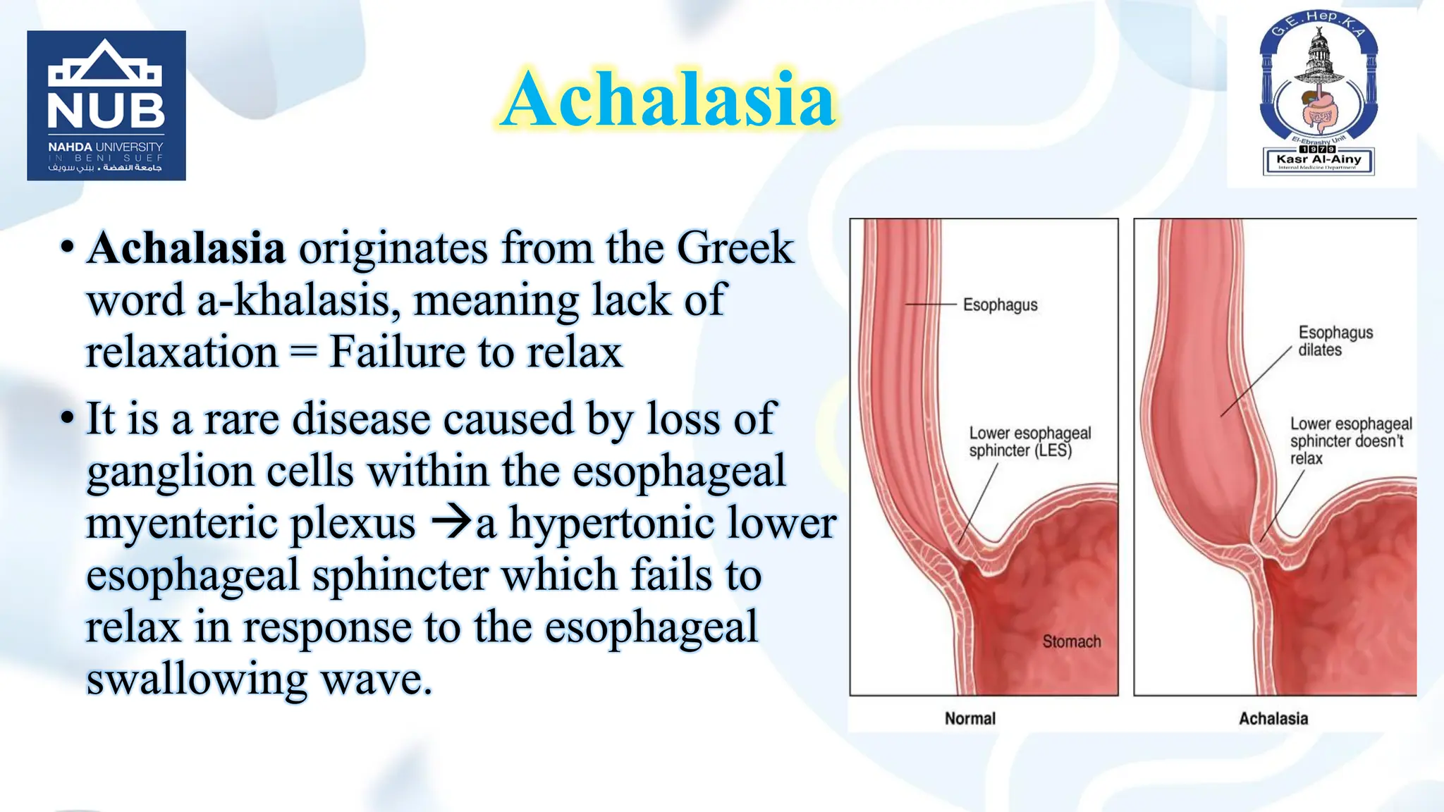 Dysphagia and Achalasia undergraduate lecture | PDF