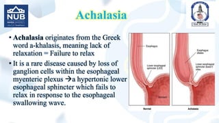 Dysphagia and Achalasia undergraduate lecture | PDF