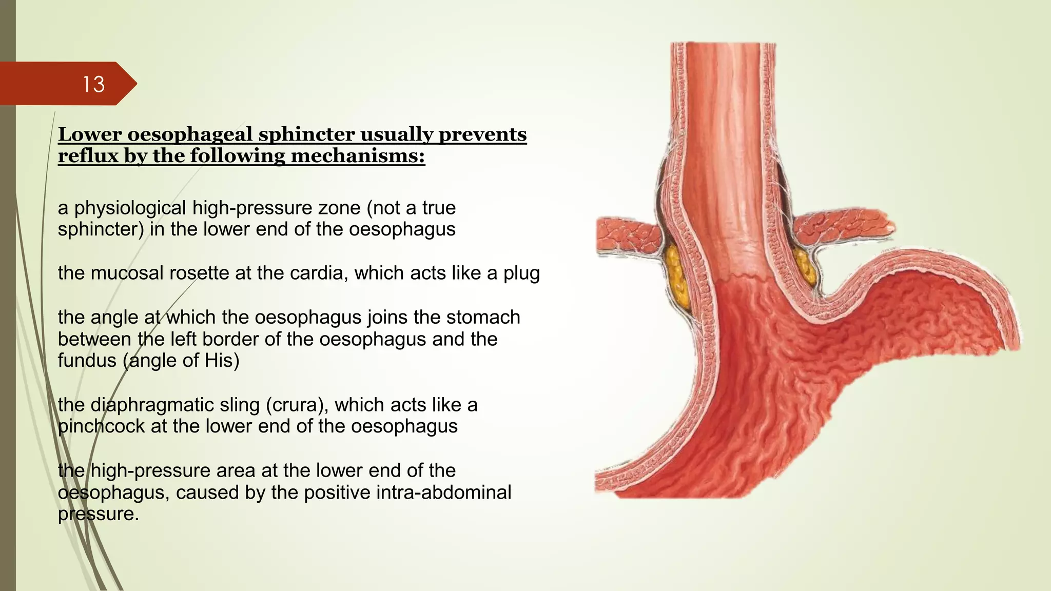 Dysphagia and esophagus | PDF