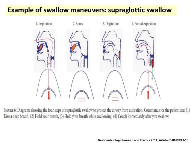 Dysphagia in the elderly@apr2014 present