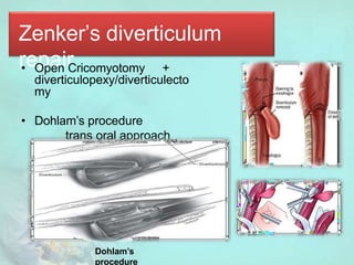 dysphagianew-160204163218.pptx