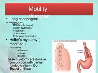 dysphagianew-160204163218.pptx