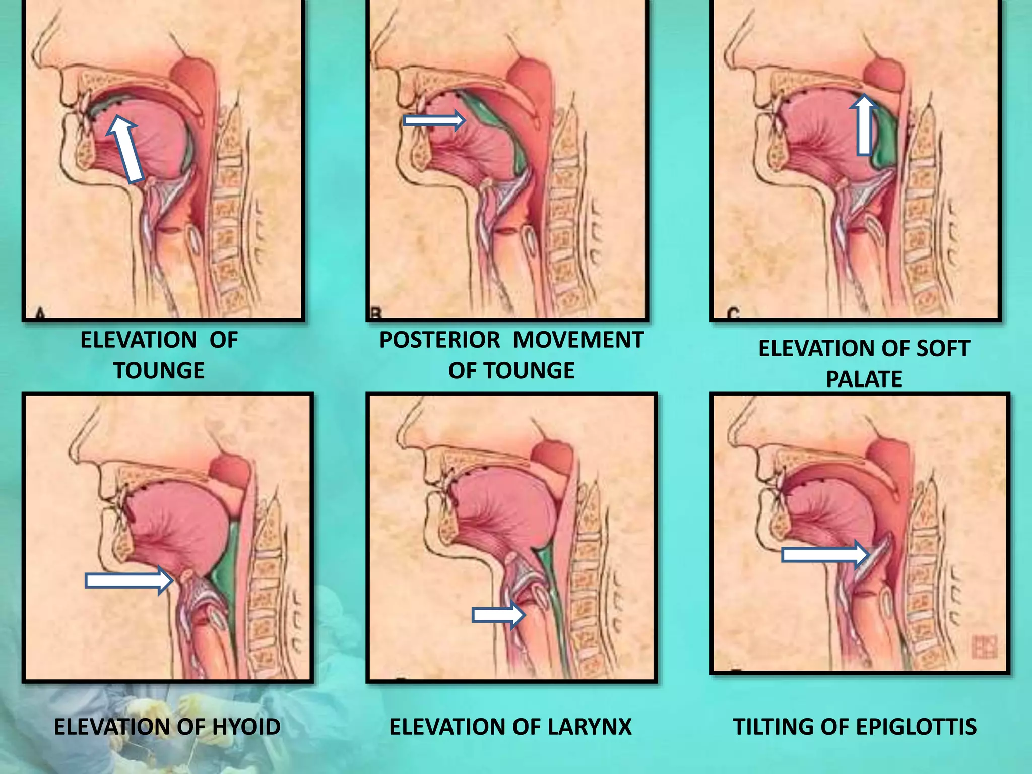 Dysphagia | PPTX