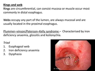 Dysphagia – non malignant causes | PPTX