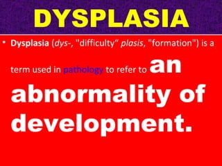 Dysplasia by dr manzoor n | PPT