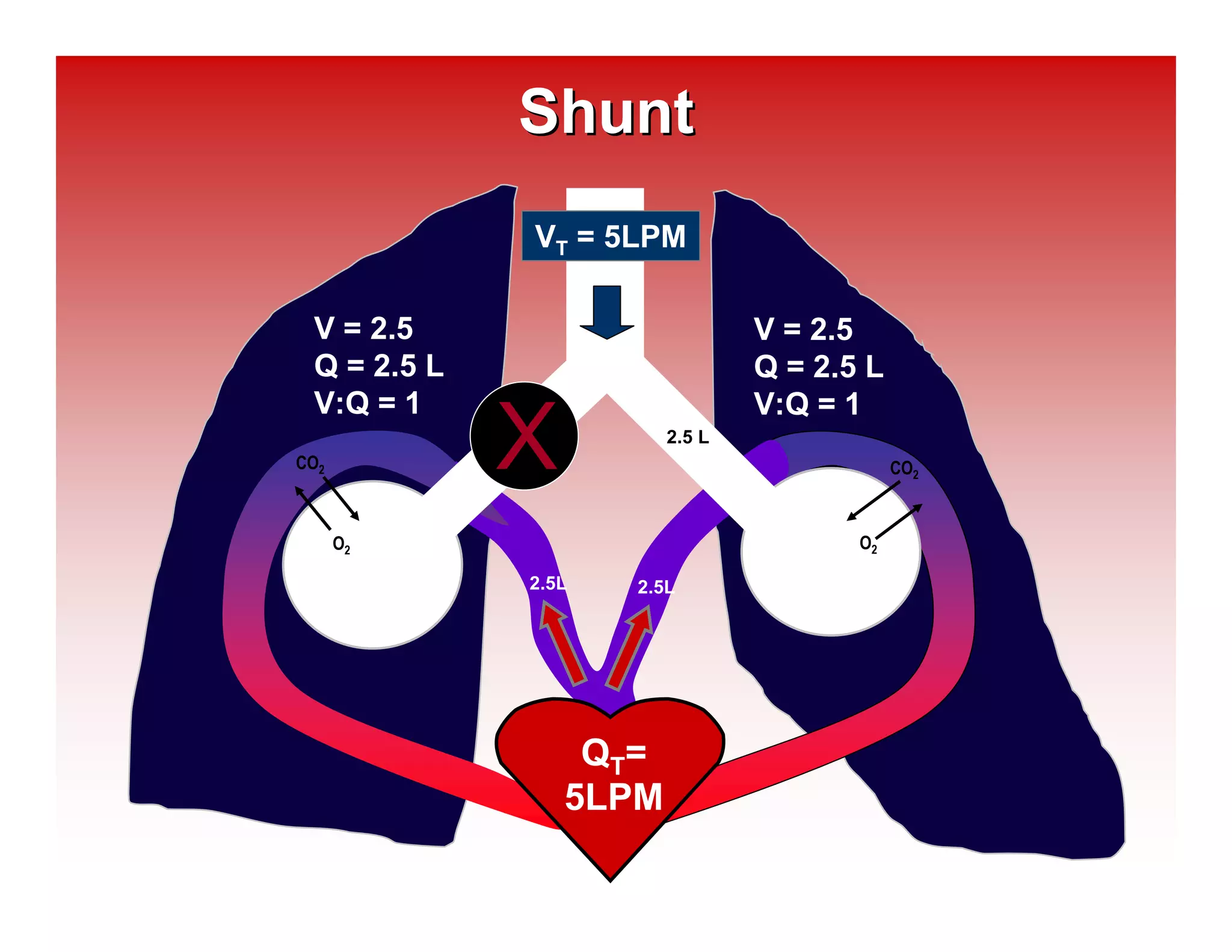 Dyspnea redone | PDF