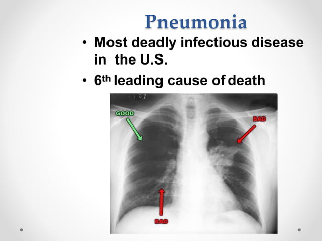 Dyspne, cough & Resp infection by Abhi.pptx