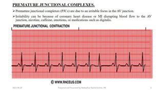 DYSRHTHMIAS_ORIGINATING_IN_THE_ATRIOVENTRICULAR_JUNCTION-1.pptx