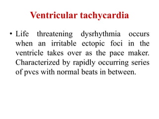 Arrhythmia | PPSX