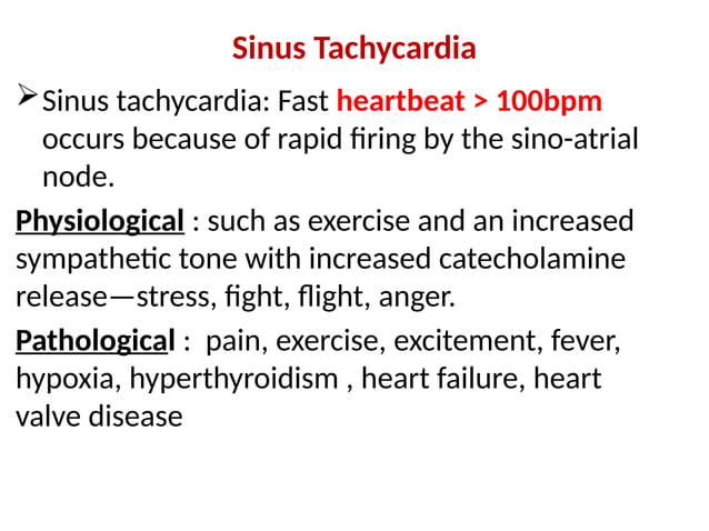 lecture on Dysrhythmias of Sino-atrial Node | PPT