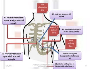 Dysrrhythmia, major arrhythmias and management, bascs of ECG. | PPSX