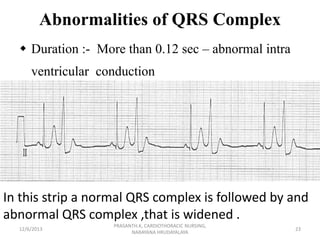 Dysrrhythmia, major arrhythmias and management, bascs of ECG. | PPSX