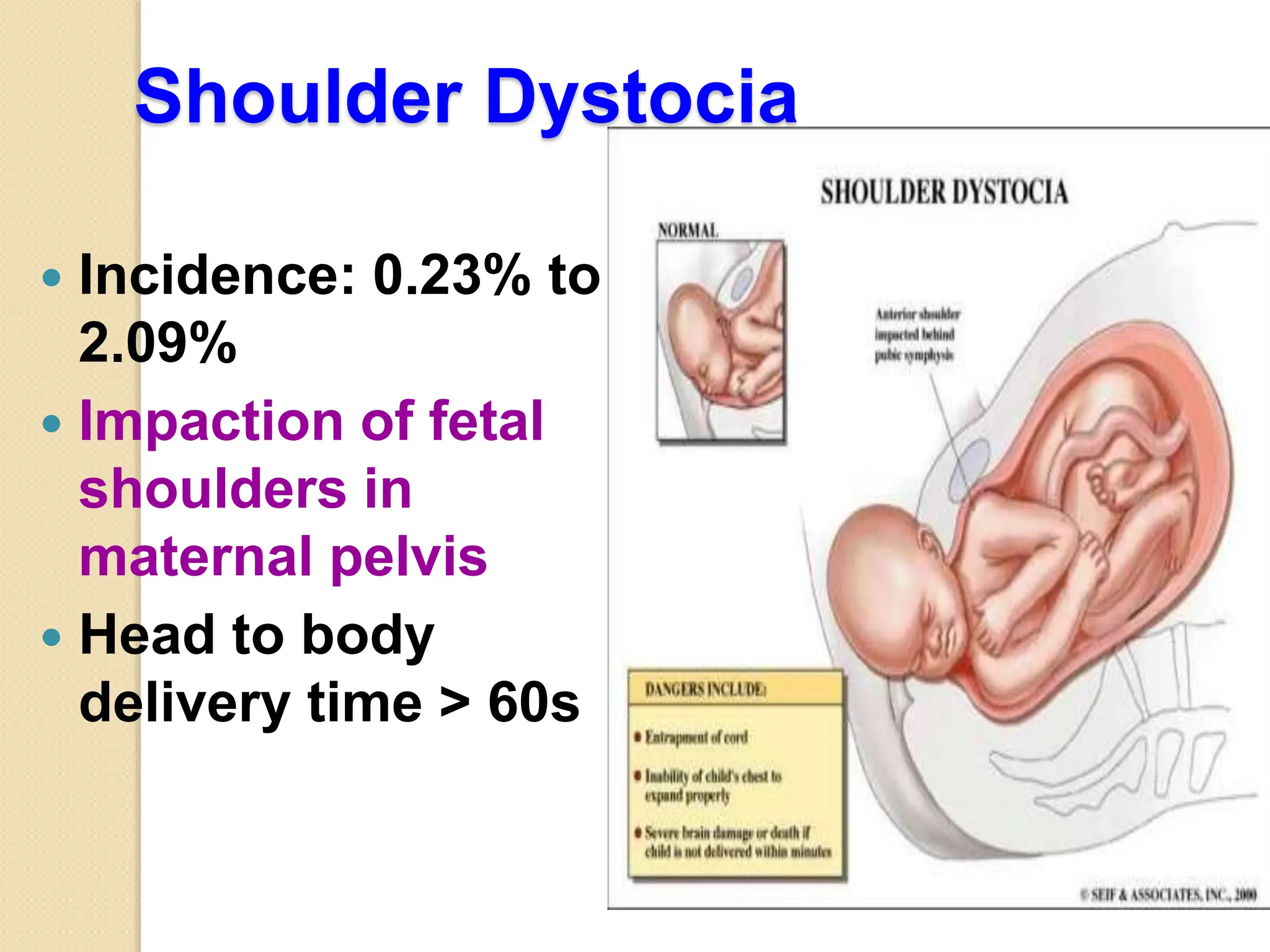 DYSTOCIA.ppt