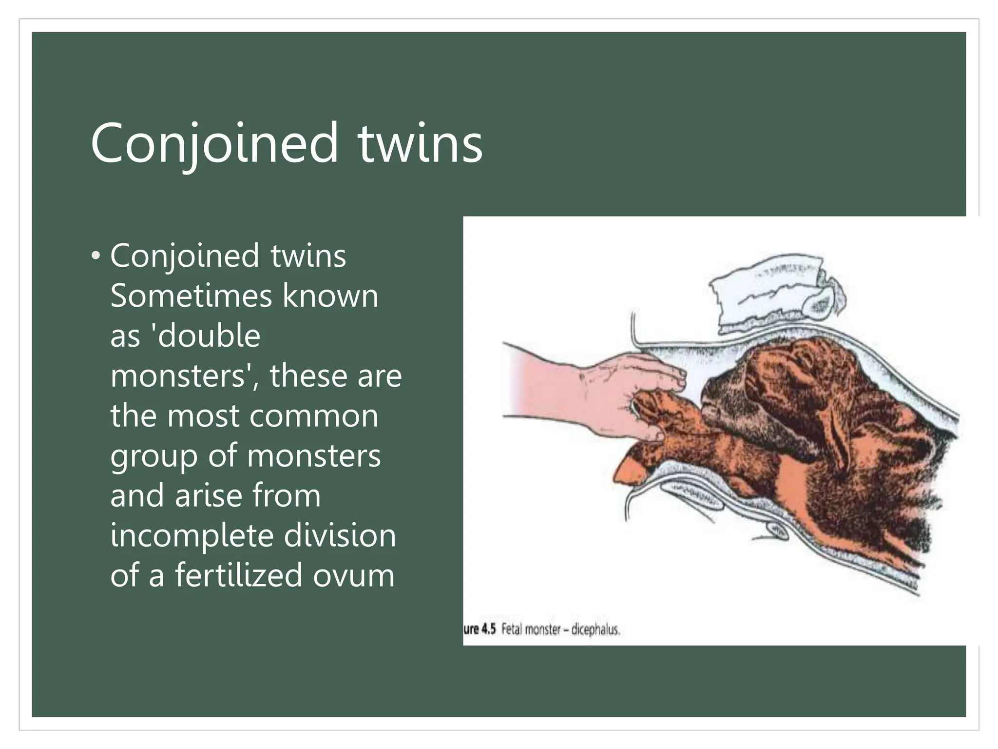 dystocia in cattle sheep and goat.pptx
