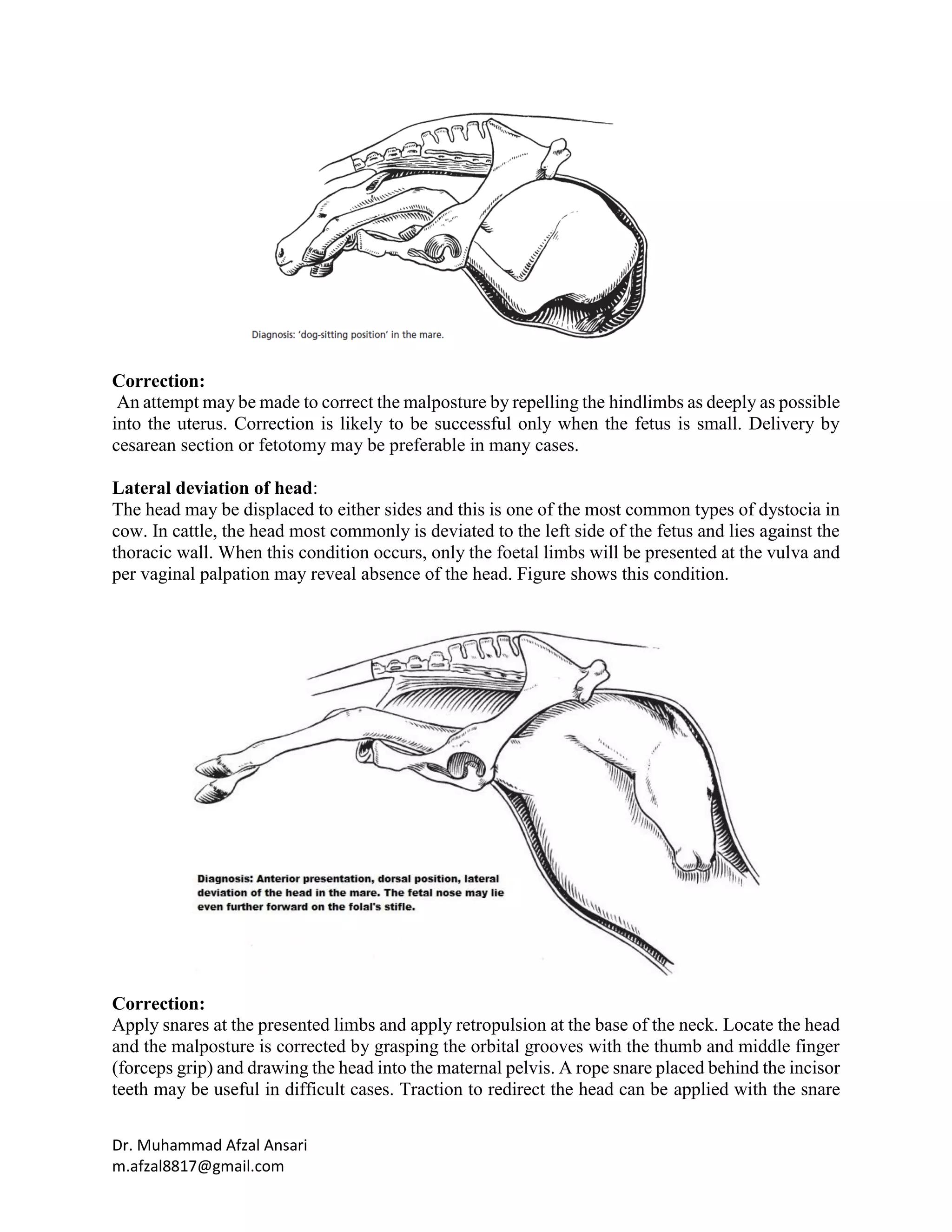 Dystocia due to faulty position, presentation and posture and their ...