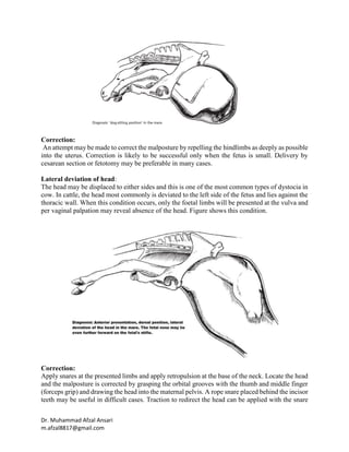 Dystocia due to faulty position, presentation and posture and their ...