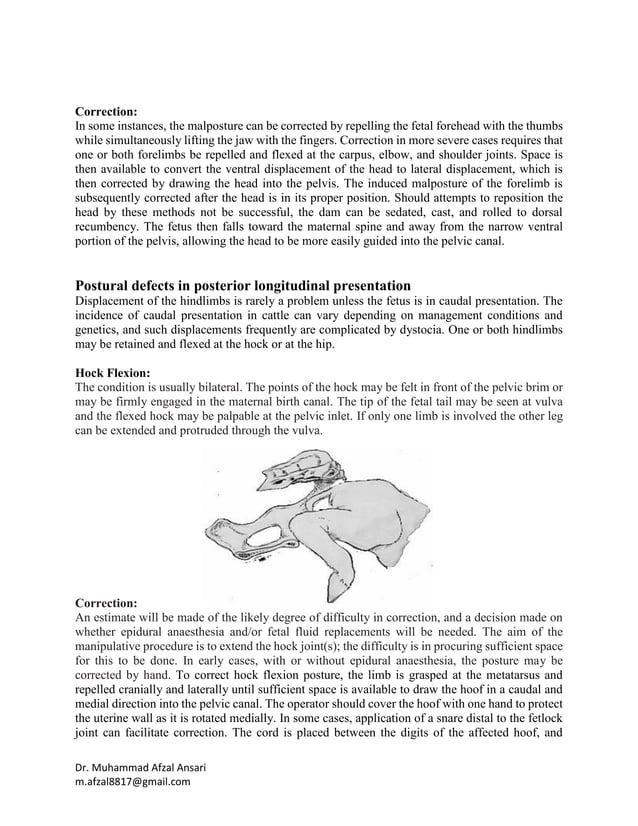 Dystocia due to faulty position, presentation and posture and their ...