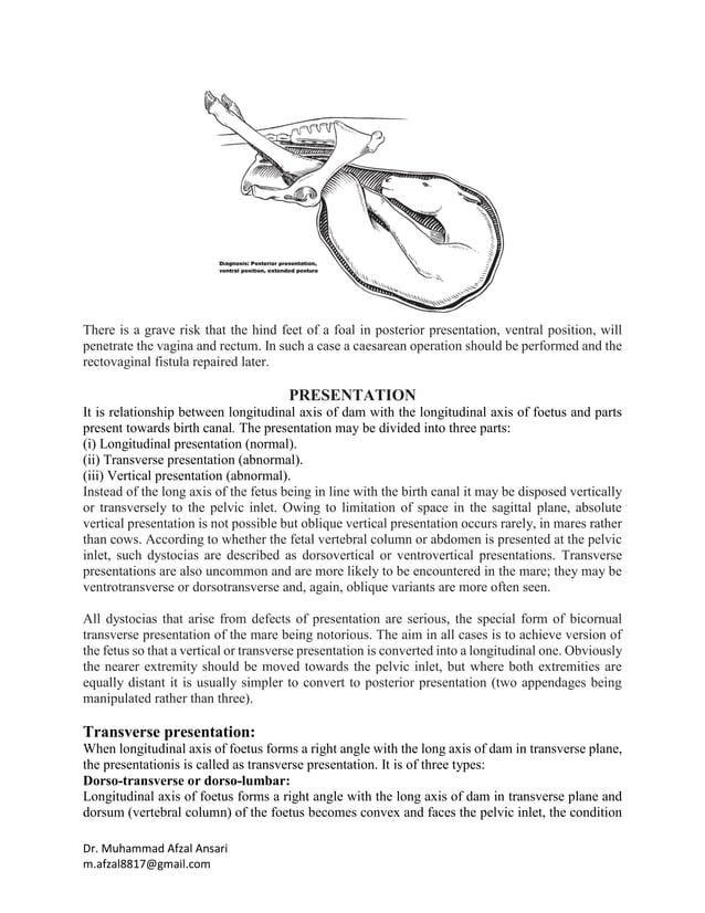Dystocia due to faulty position, presentation and posture and their ...
