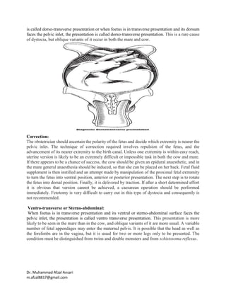 Dystocia due to faulty position, presentation and posture and their ...