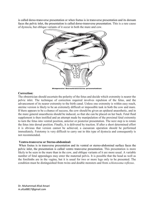 Dystocia due to faulty position, presentation and posture and their ...