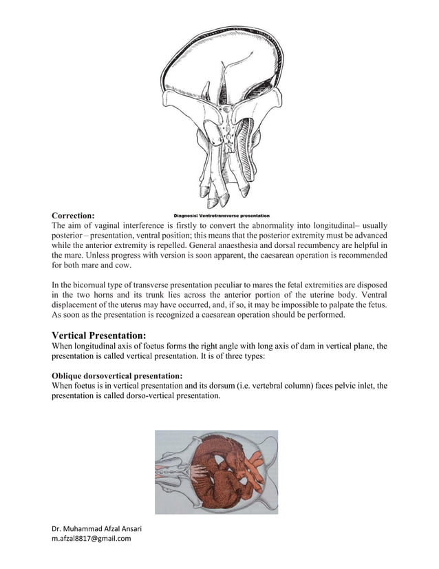 Dystocia due to faulty position, presentation and posture and their ...