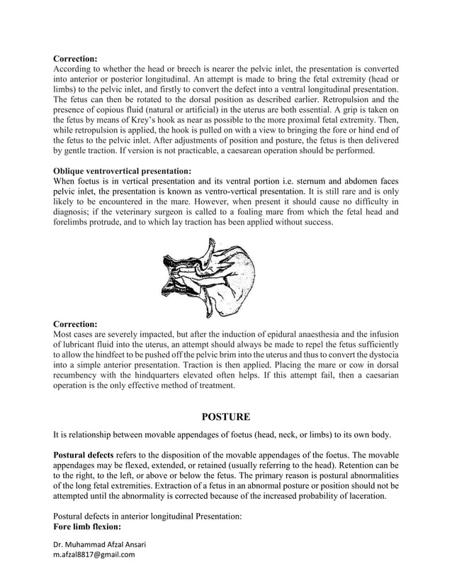 Dystocia due to faulty position, presentation and posture and their ...