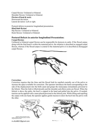 Dystocia due to faulty position, presentation and posture and their ...