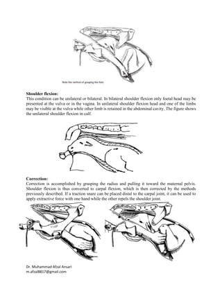 Dystocia due to faulty position, presentation and posture and their ...