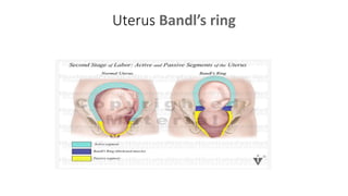 Dystocia mechanic (Obstructed Dystocia).pdf
