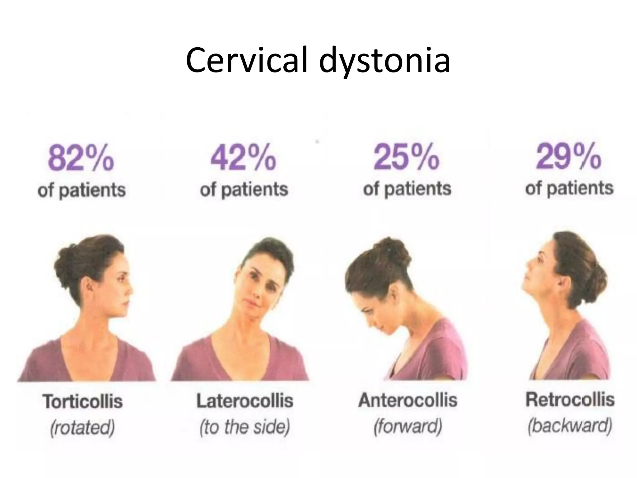Dystonia | PDF