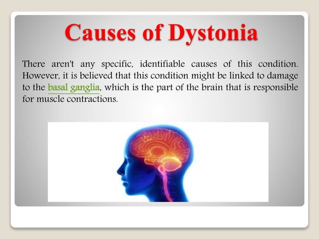 Dystonia: Causes, Types, Symptoms, and Treatments | PPTX | Brain and ...